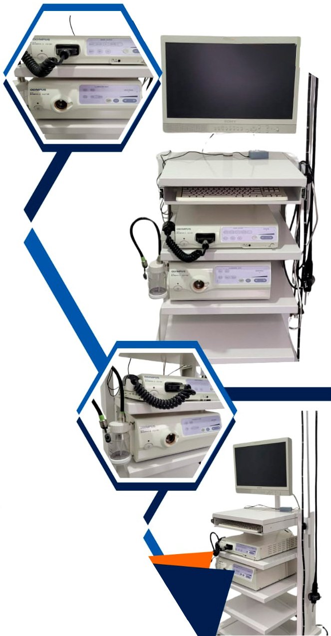 Olympus | Endoscopia y Colonoscopia
